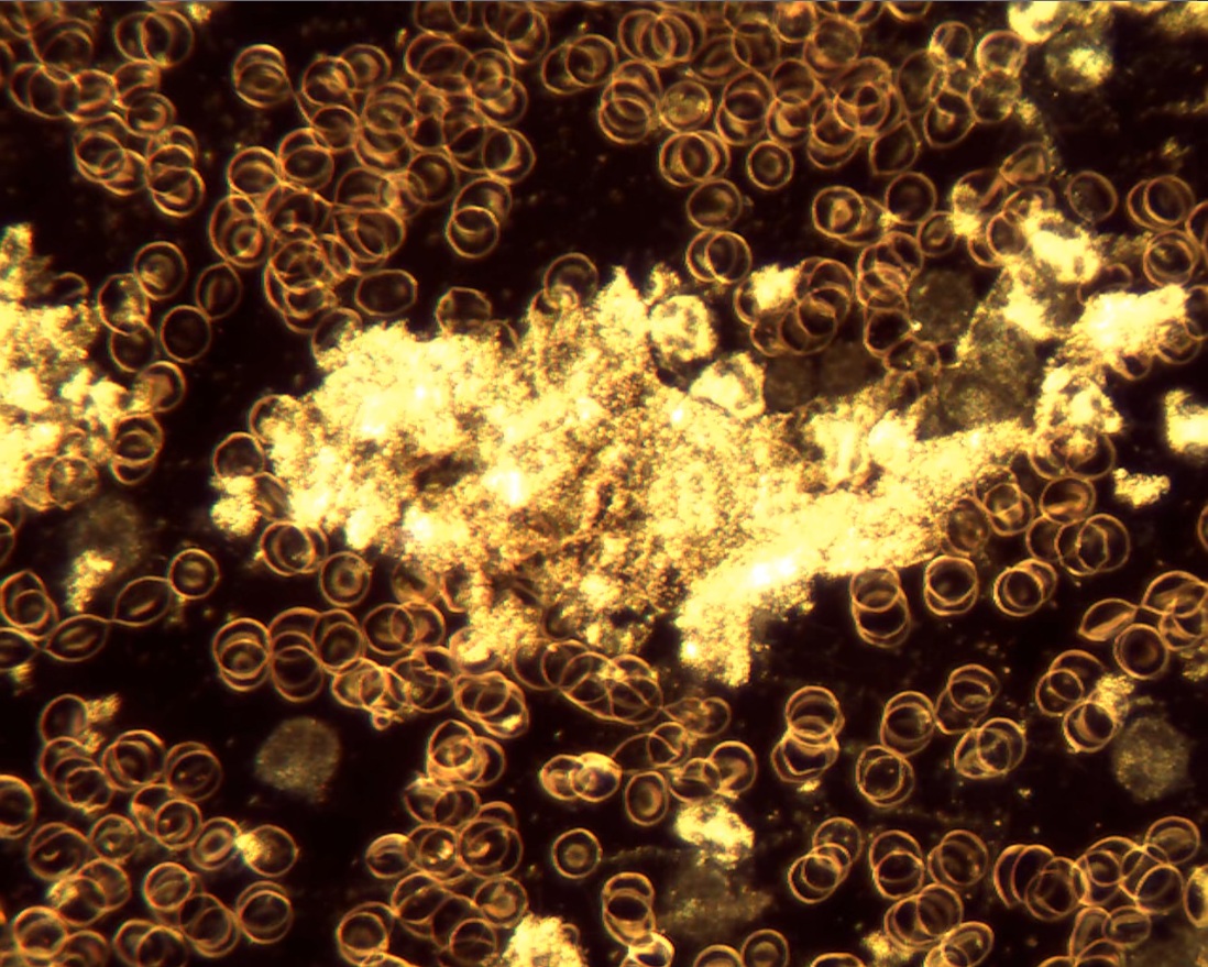 Therapie resistentie bij Lyme door Biofilms