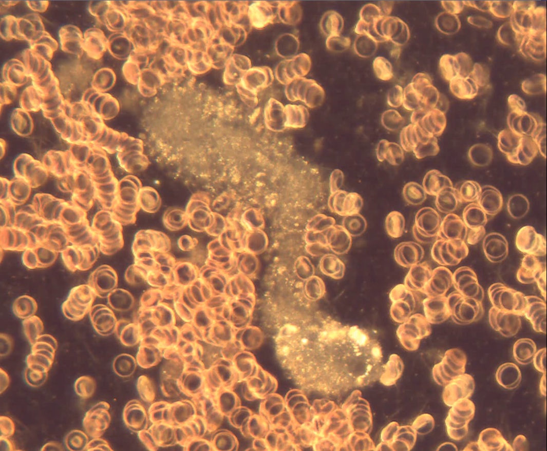 Biofilm2 - LymeBehandeling.nl
