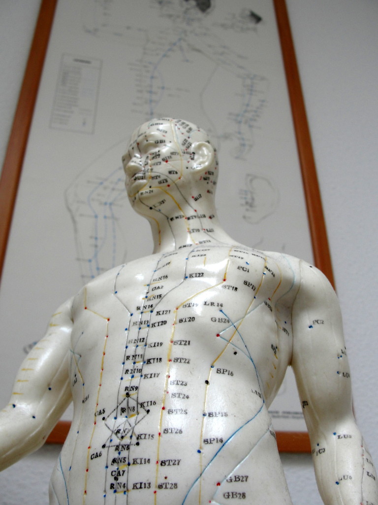 Acupunctuur bij Lyme